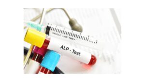 Alkaline phosphatase isoenzymes - ScienceQuery
