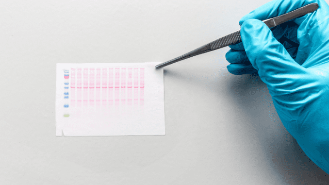 How to detect proteins by Western blotting - ScienceQuery