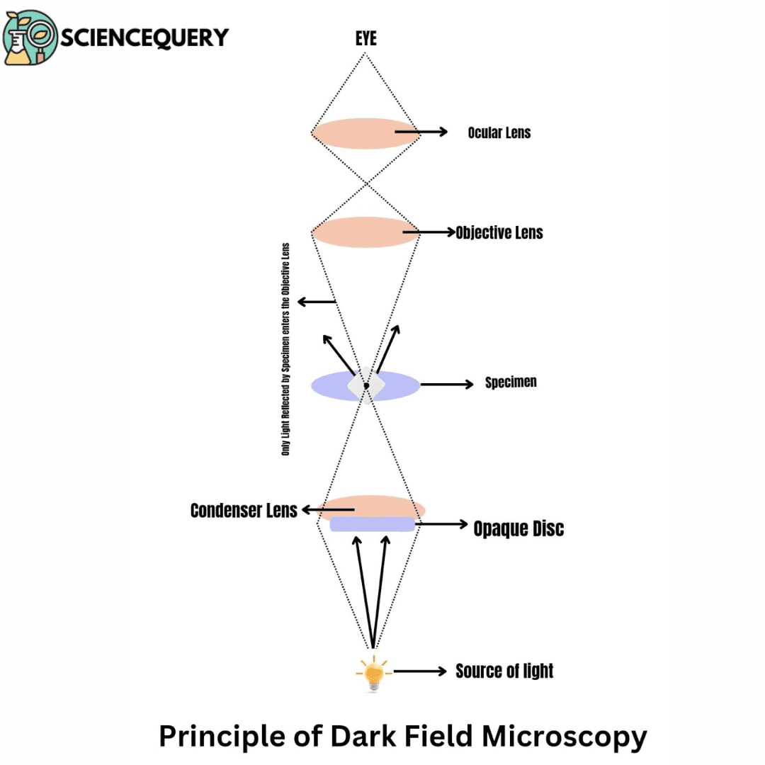 Dark Field Microscope - Science Query