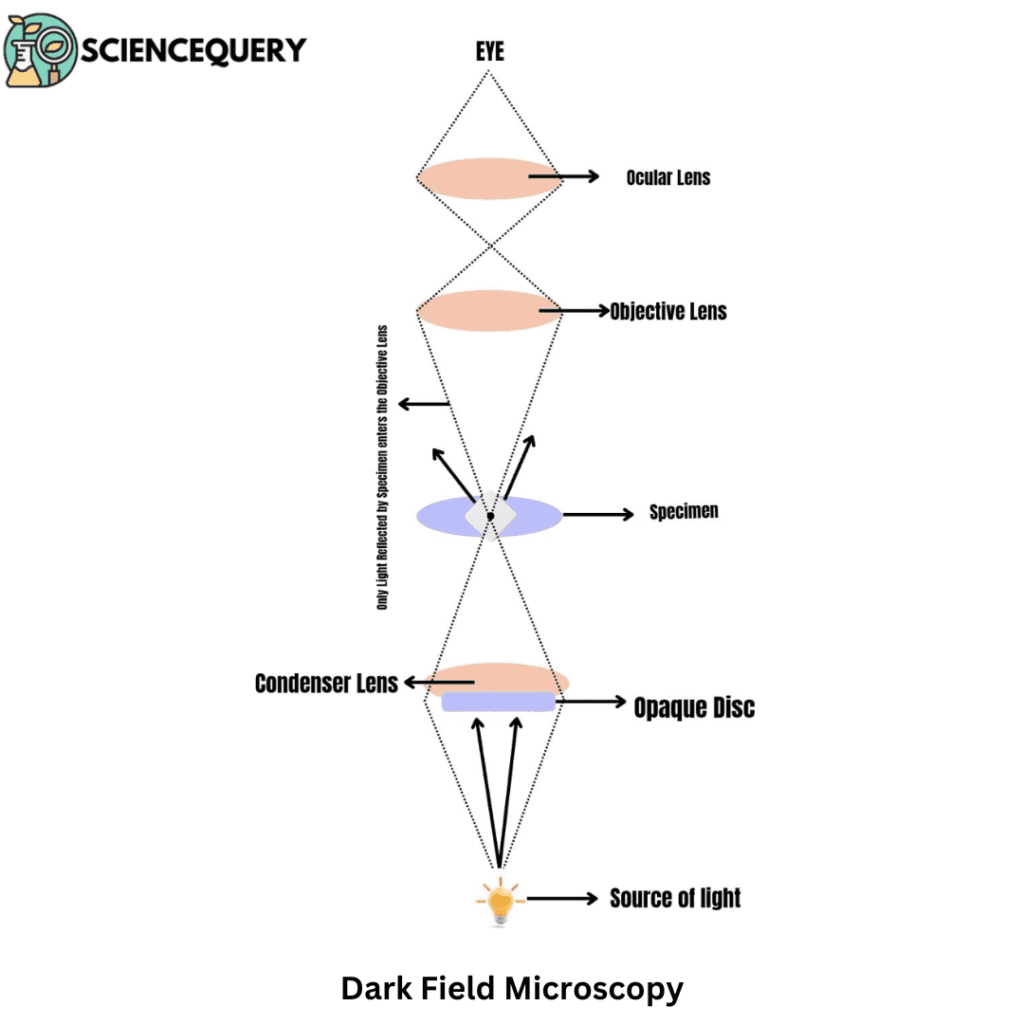 Dark Field Microscope - ScienceQuery