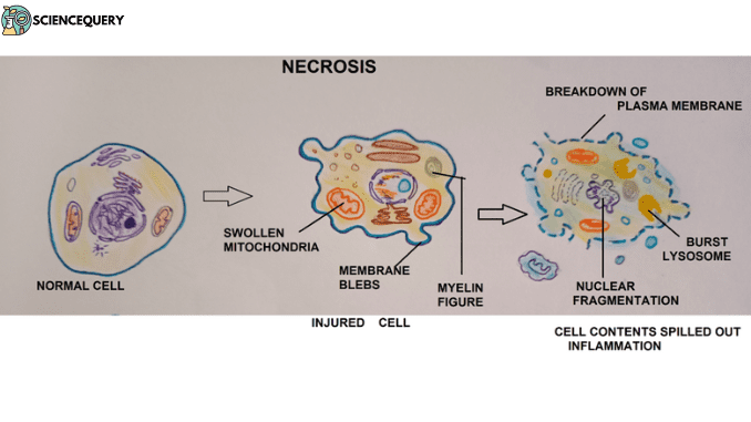 Apoptosis and Necrosis - ScienceQuery